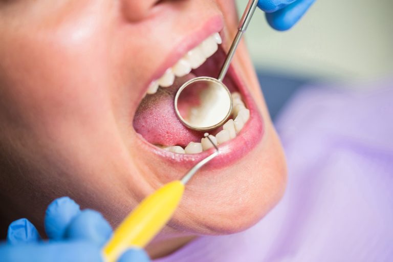 Premium Dental Fillings at QEM | Tooth Filling Cost in Dubai