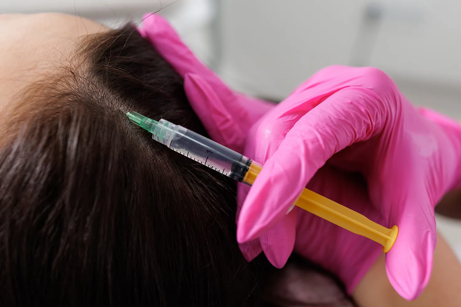 PRP Treatment in Dubai Marina | Platelet Rich Plasma Therapy